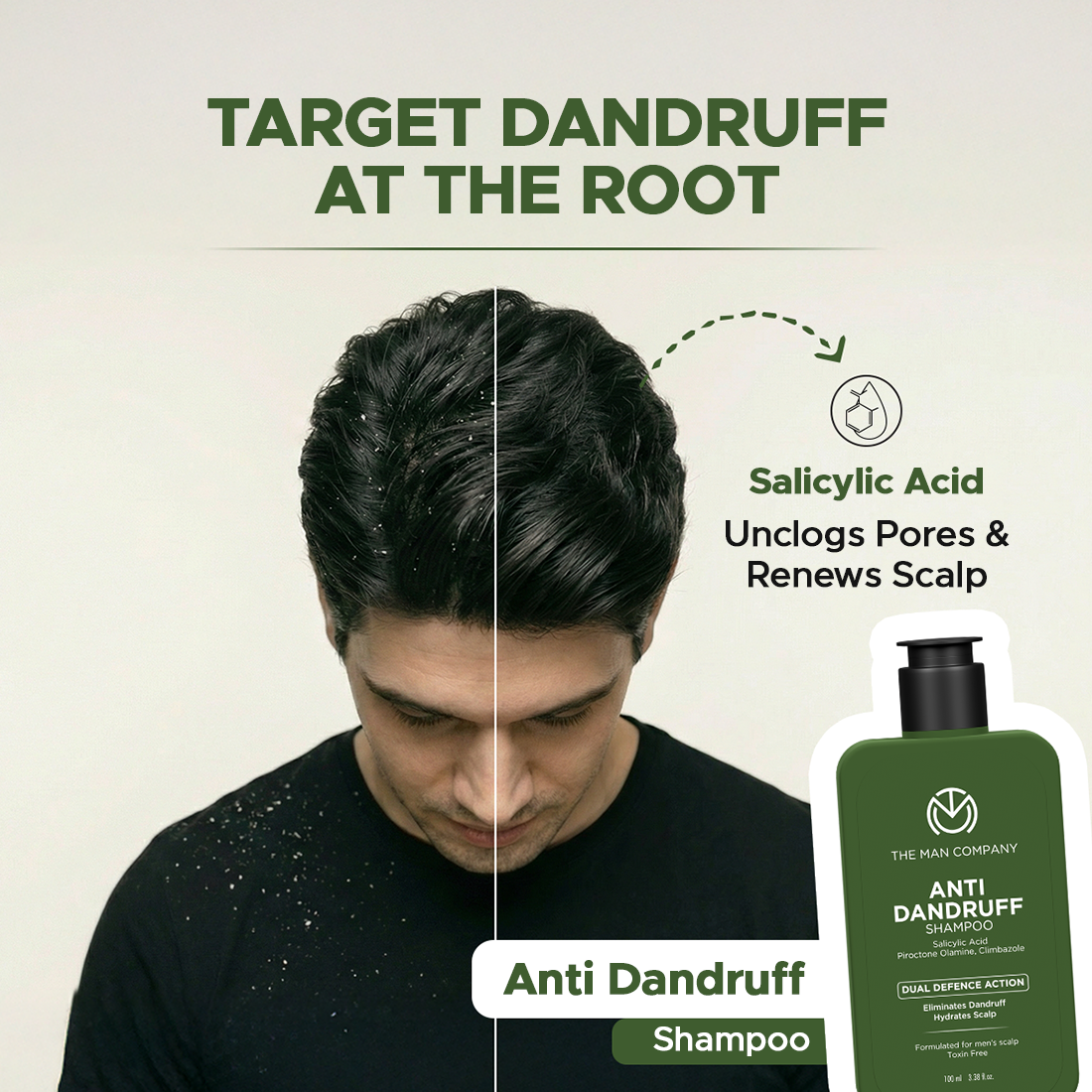 The Man Company Anti-Dandruff Shampoo | AHA & BHA Scalp Care