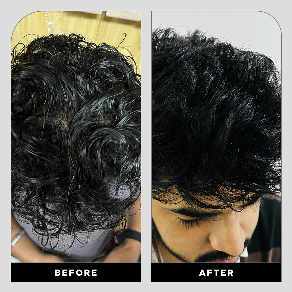 Fight Premature Greying with The Man Company's Grey Hair Remedy Kit