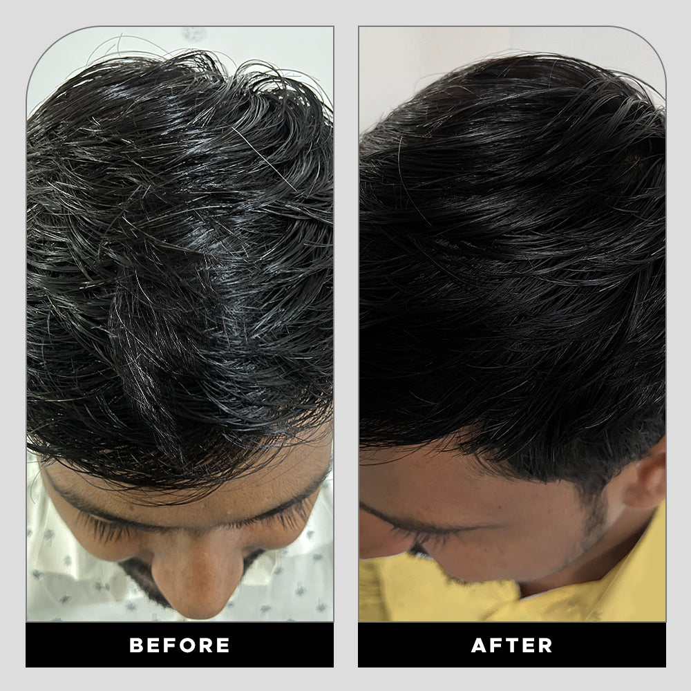 Best Grey Shampoo for Men - Anti-Greying Shampoo & Conditioner – The ...
