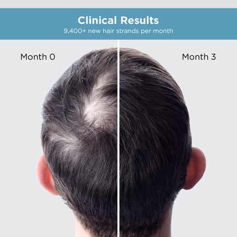 Hair Growth Series for Men | Powered by Clinically Proven Ingredients ...
