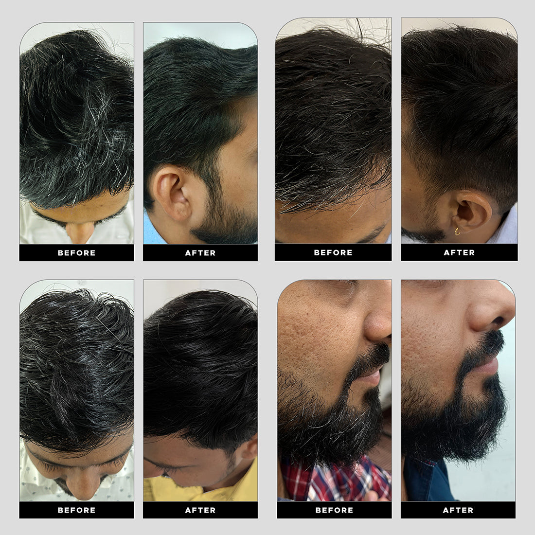 Beard Growth Products | Best Beard Growth Oils | Beard Care | The Man ...