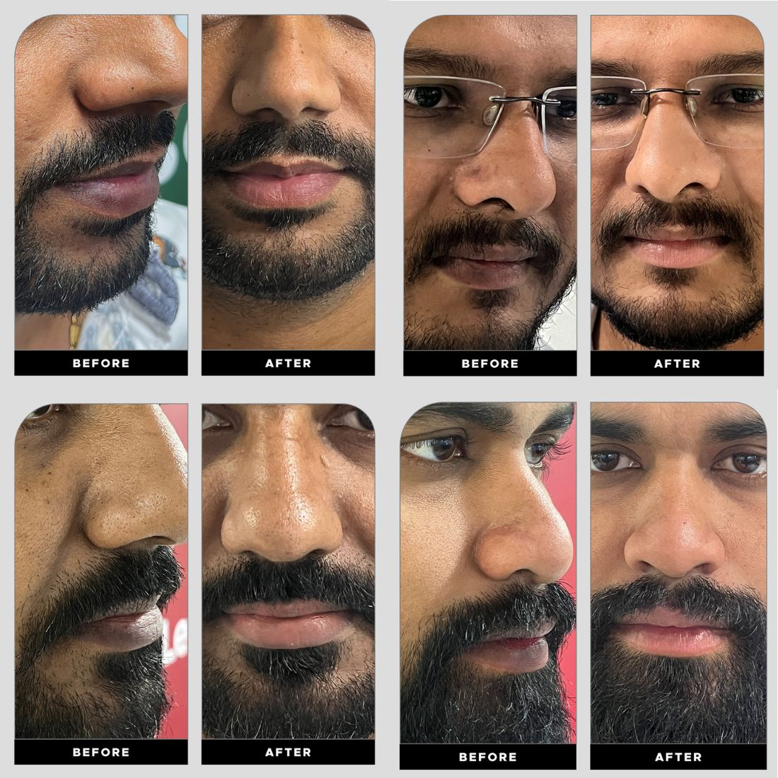 Lip Scrub – The Man Company