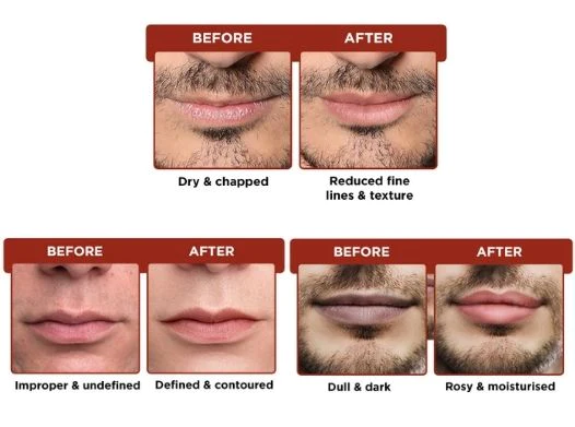 The Man Company Lightening Lip Balm SPF15 for Men